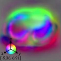 TransMorph: Transformer for Unsupervised Medical Image Registration ...