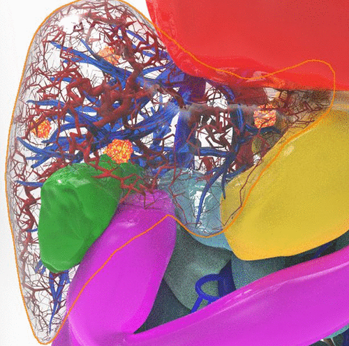 CVIT Research Featured on the Cover of Radiology - CVIT - Center for ...