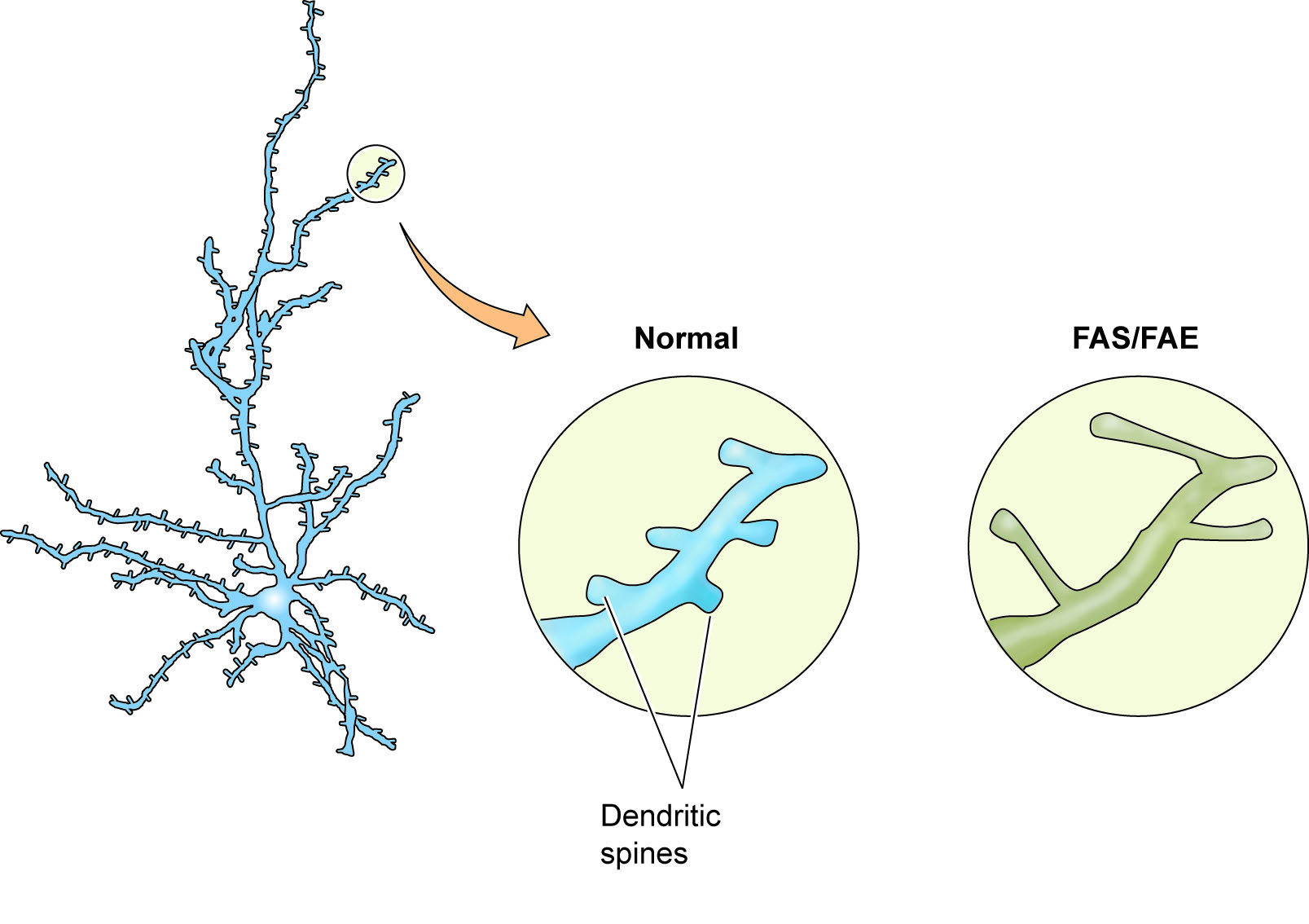 Brain Imaging Reveals Structural Defects – Understanding Fetal Alcohol ...