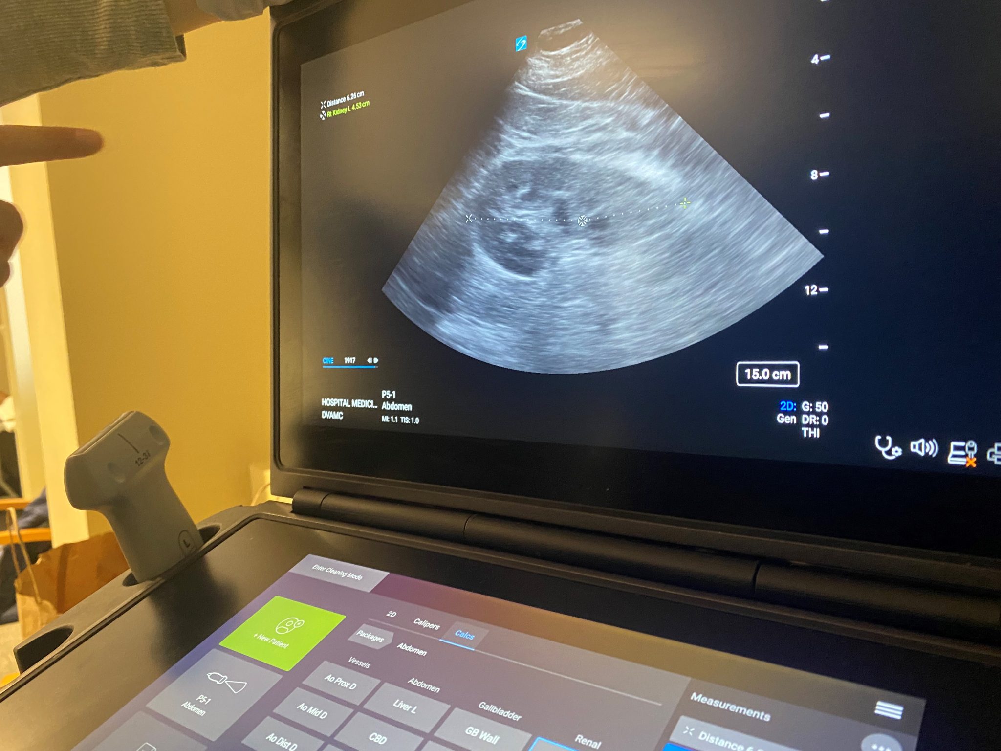 Ultrasound – Duke Nephrology Fellowship Curriculum
