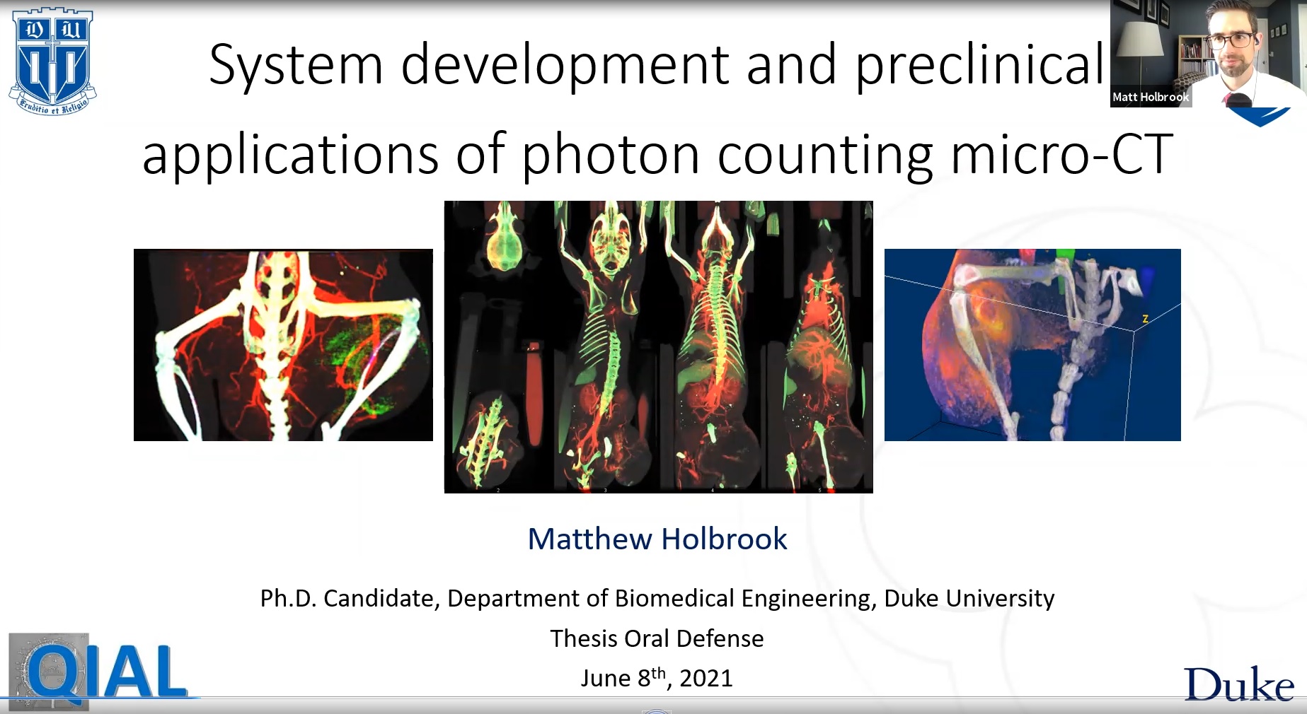 Congratulations Dr. Matt Holbrook! | Quantitative Imaging and Analysis Lab